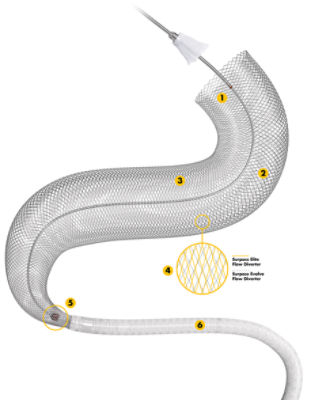 Surpass Elite Flow Diverter | Stryker